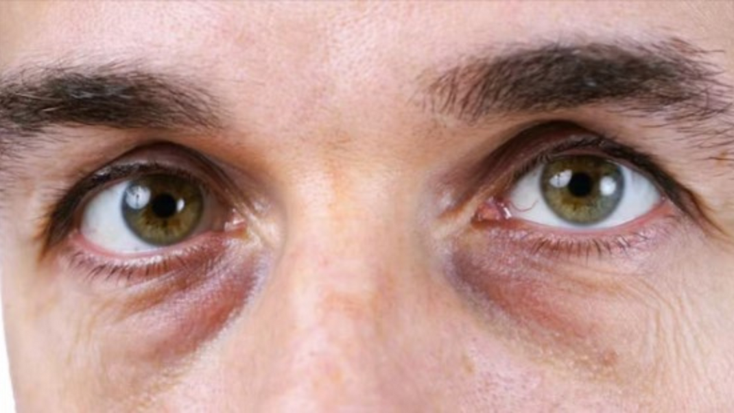 Zevorify Eye Repair Stick