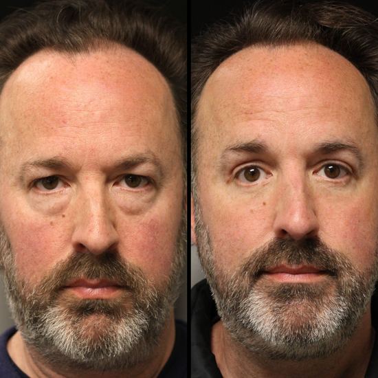 Zevorify Eye Repair Stick