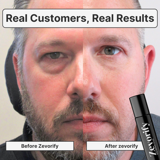 Zevorify Eye Repair Stick