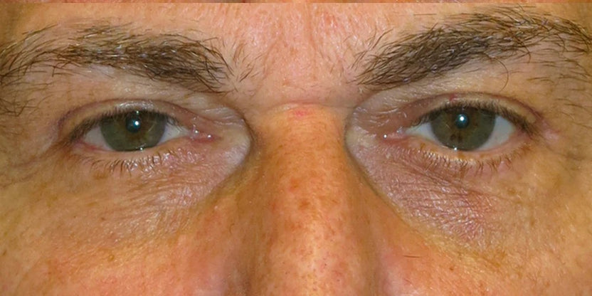 Zevorify Eye Repair Stick