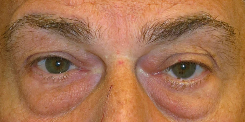 Zevorify Eye Repair Stick